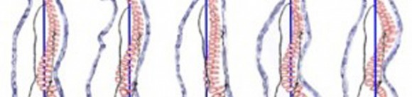 How to Improve Bad Posture